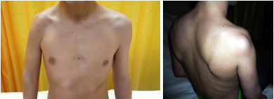 Scapola alata | Gianluigi Di Gennaro